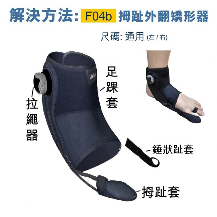 Medex F04b - Hallux Valgus Alignment Splint( with cinch device) I FDA ...
